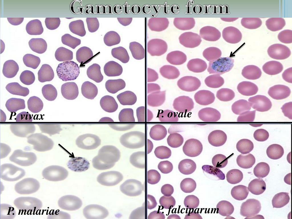 PPT - Medical Parasitology Lab. Revision PowerPoint Presentation, free ...