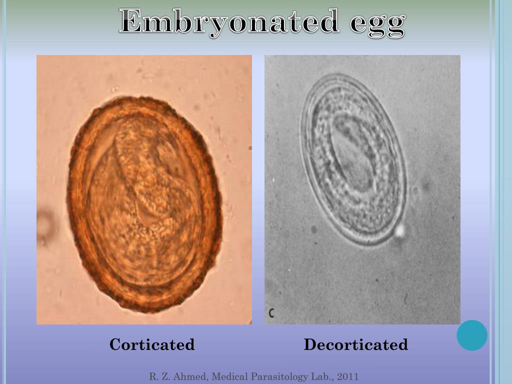 PPT - Medical Parasitology Lab. Revision PowerPoint Presentation, free ...