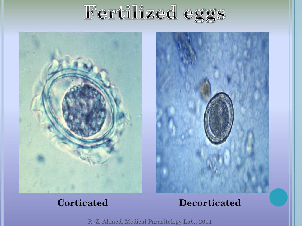 PPT - Medical Parasitology Lab. Revision PowerPoint Presentation, free ...