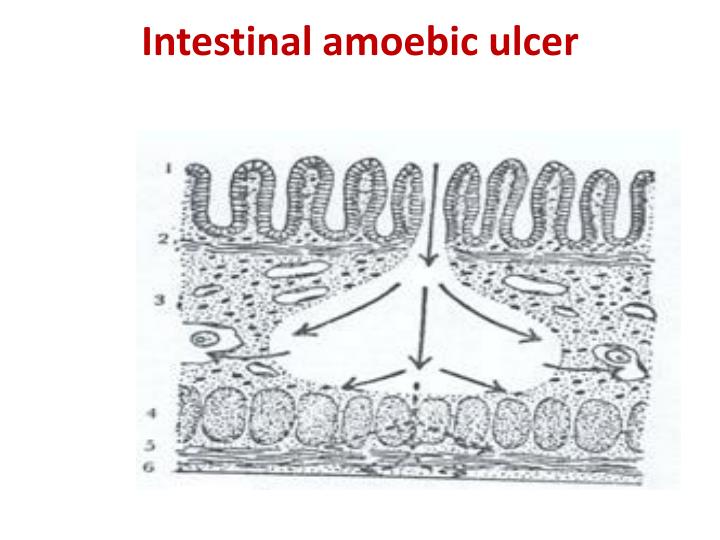 PPT - Entamoeba histolytica Pathogenesis and pathology PowerPoint ...