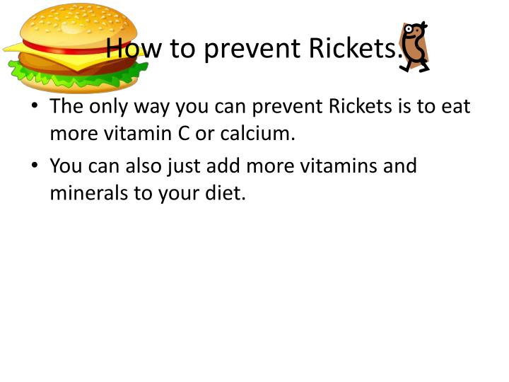 PPT - Rickets PowerPoint Presentation - ID:2300673