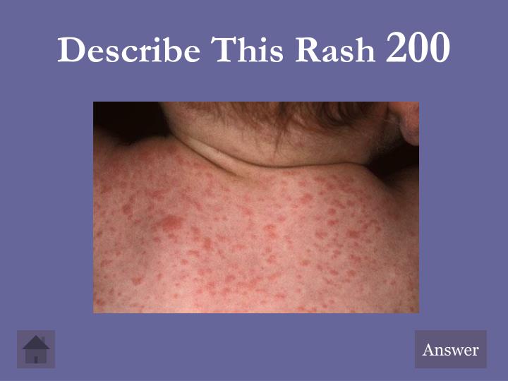 PPT - JEOPARDY Visual Diagnosis PowerPoint Presentation - ID:2300998