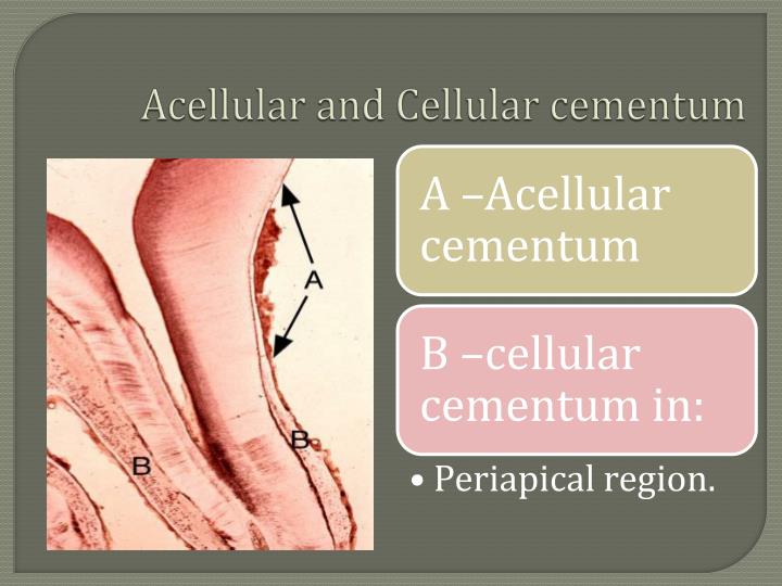 PPT - Cementum / Periodontium PowerPoint Presentation - ID:2302095