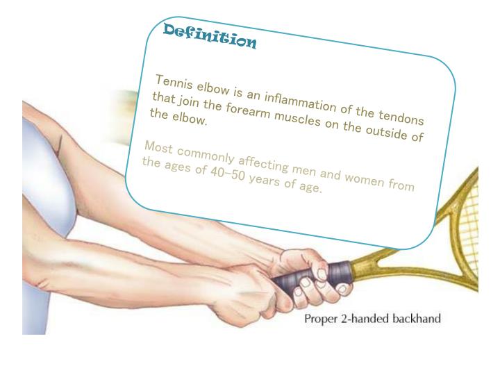 PPT - TENNIS ELBOW PowerPoint Presentation - ID:2302829