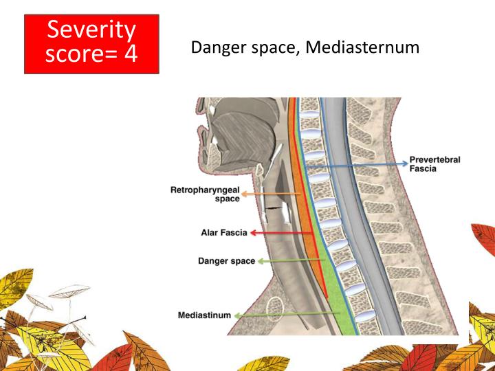 PPT - Odontogenic infection in maxillofacial region PowerPoint ...