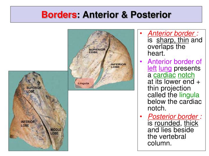 PPT - Pleura and Lung PowerPoint Presentation - ID:2308086