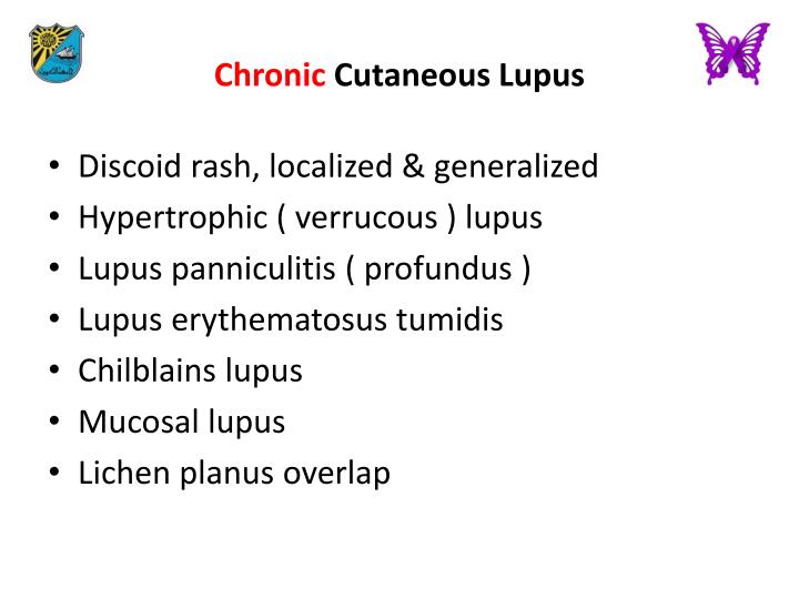 PPT - Systemic Lupus Erythematosus Internist Update PowerPoint ...