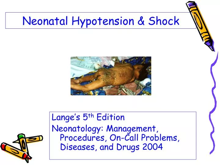 PPT - Neonatal Hypotension & Shock PowerPoint Presentation, free ...