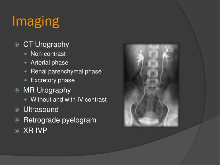 PPT - Haematuria PowerPoint Presentation - ID:2309240