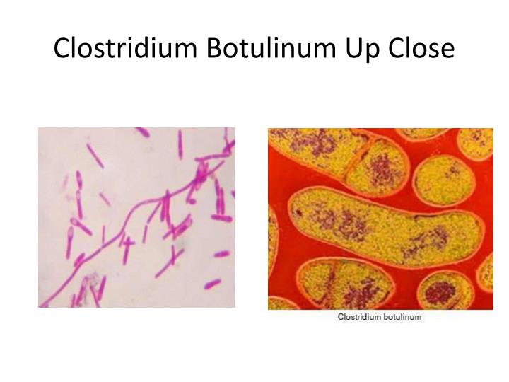 PPT - Clostridium Botulinum PowerPoint Presentation - ID:2312973