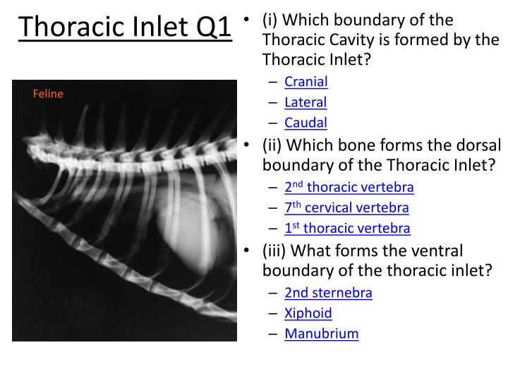 PPT - Thoracic Body Wall & Vertebral Column Imaging Quiz PowerPoint ...