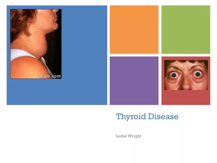 PPT - Thyroid Disease PowerPoint Presentation, free download - ID:2315594