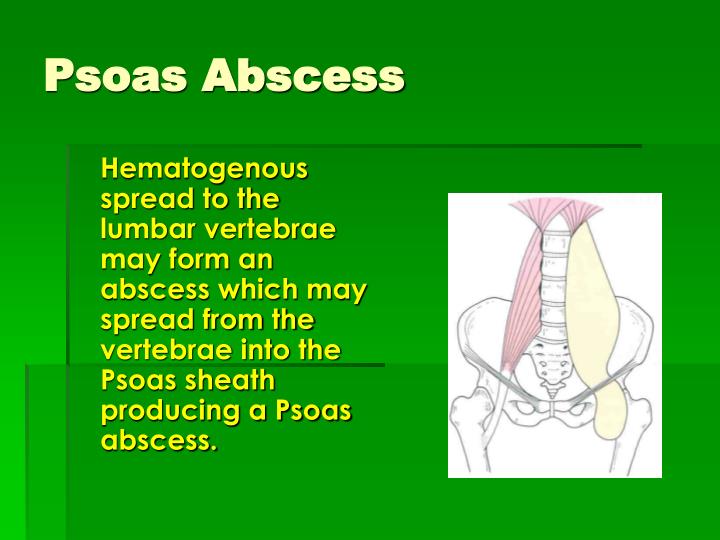PPT - Abdominal Wall & Stomach PowerPoint Presentation - ID:2316338