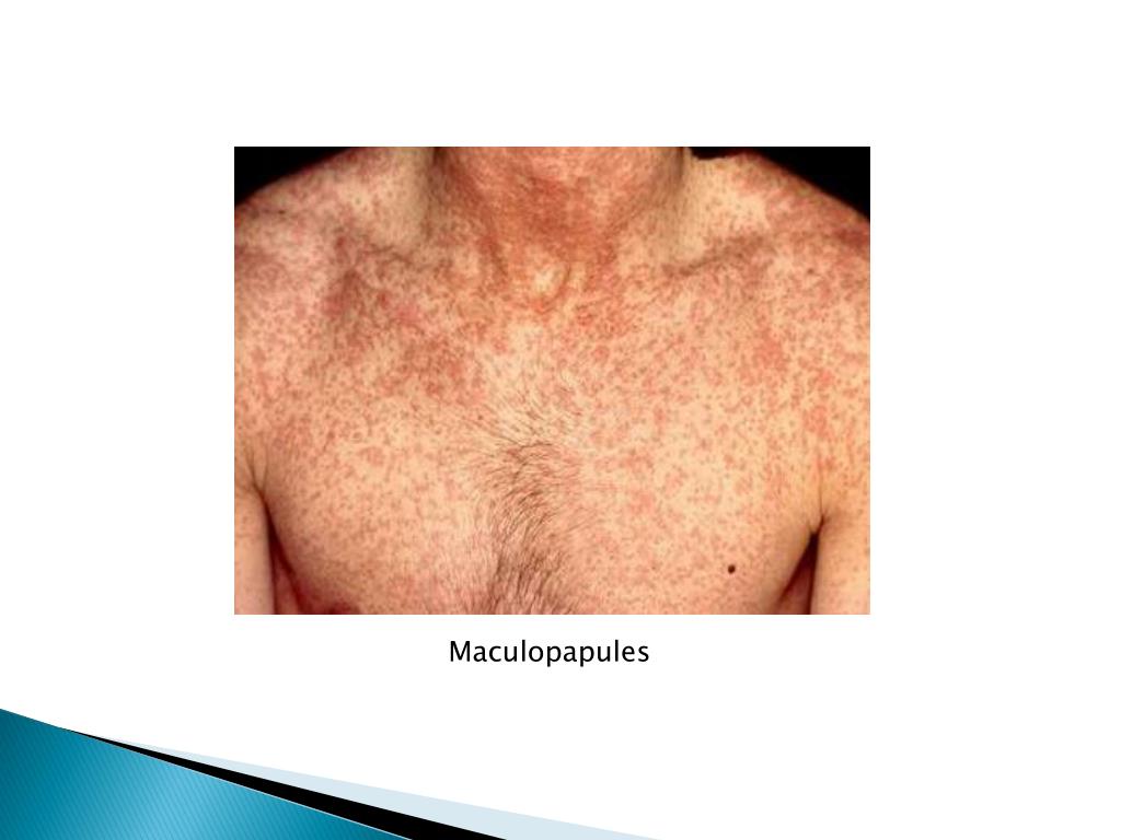 PPT - ADVERSE CUTANEOUS DRUG REACTIONS Course 393 (Prof. Marwan Al ...