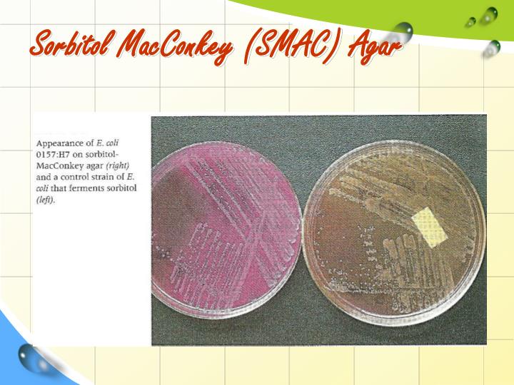 PPT - Routine & Special stool culture PowerPoint Presentation - ID:2316408