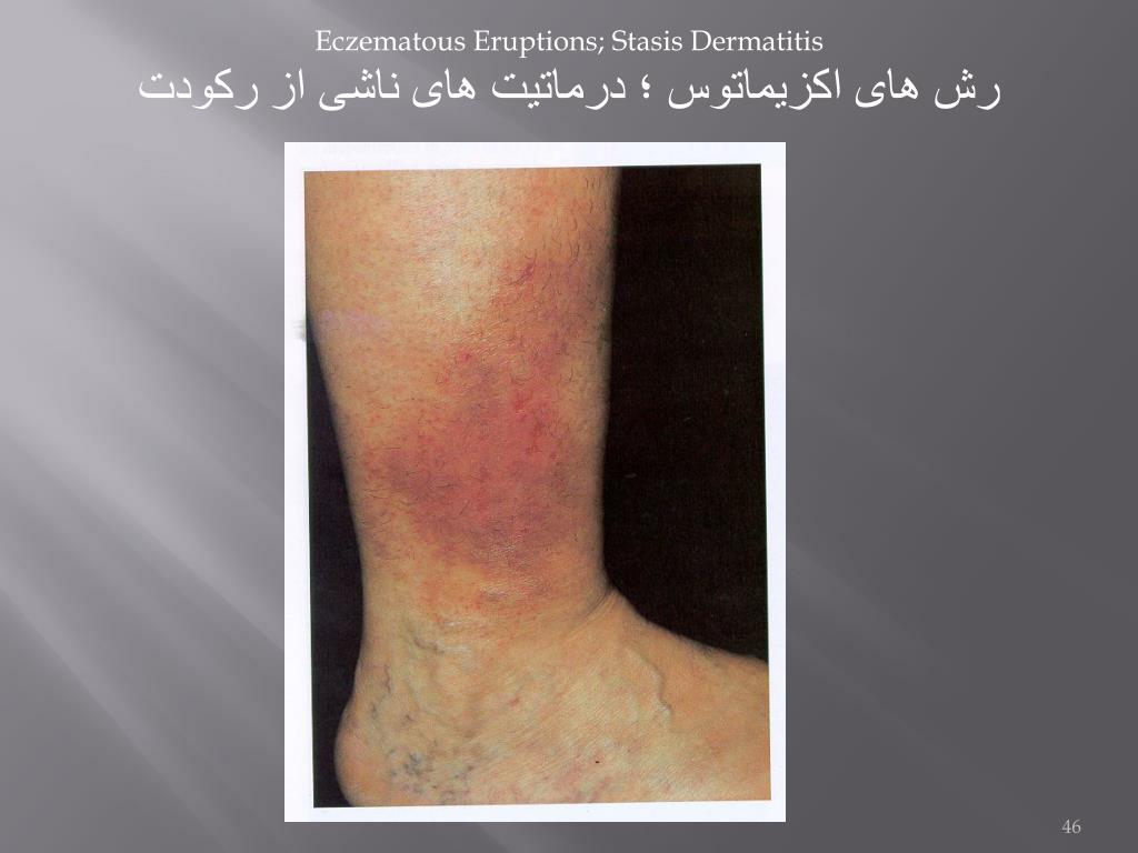 Ppt Dermatology جلدی Powerpoint Presentation Free Download Id 2316434