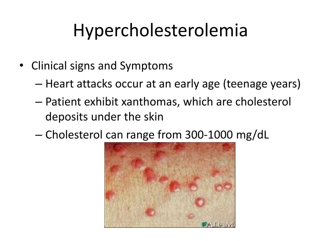 PPT - MLAB 2401: Clinical Chemistry Keri Brophy-Martinez PowerPoint ...