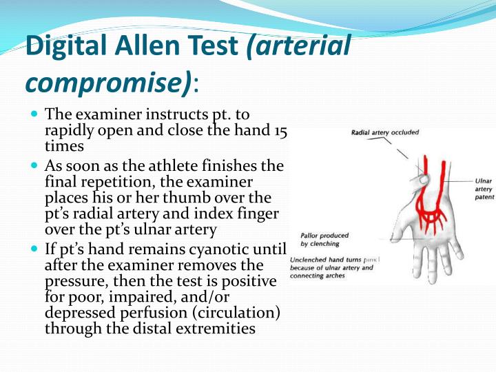PPT - Wrist & Hand Evaluation PowerPoint Presentation - ID:2317149