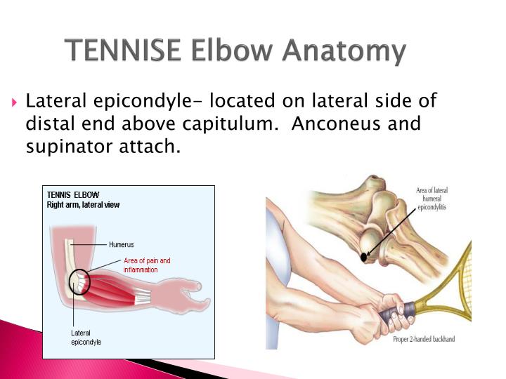 PPT - Tenise Elbow/ Golf Elbow De de Quervain's Disease PowerPoint ...