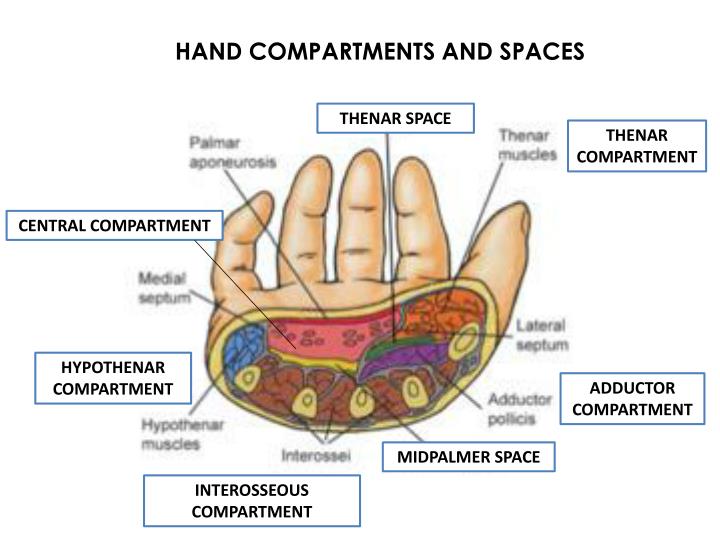 PPT - Wrist and Hand PowerPoint Presentation - ID:2317175