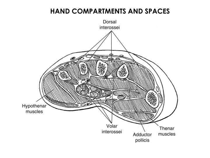 PPT - Wrist and Hand PowerPoint Presentation - ID:2317175