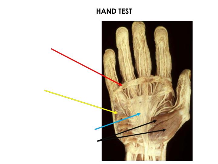 PPT - Wrist and Hand PowerPoint Presentation - ID:2317175