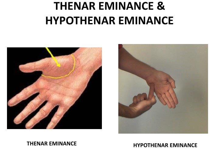 PPT - Wrist and Hand PowerPoint Presentation - ID:2317175