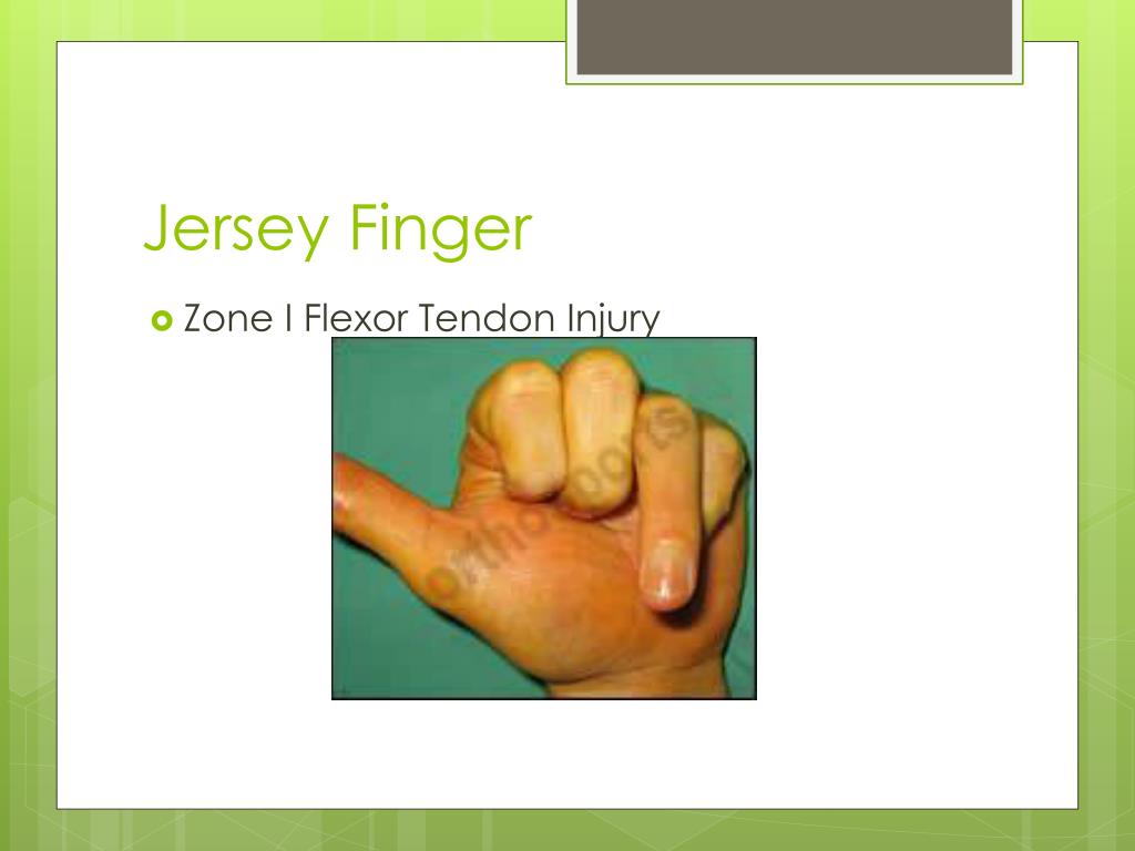 PPT - Pediatric Sports Injuries of the Wrist and Hand PowerPoint ...