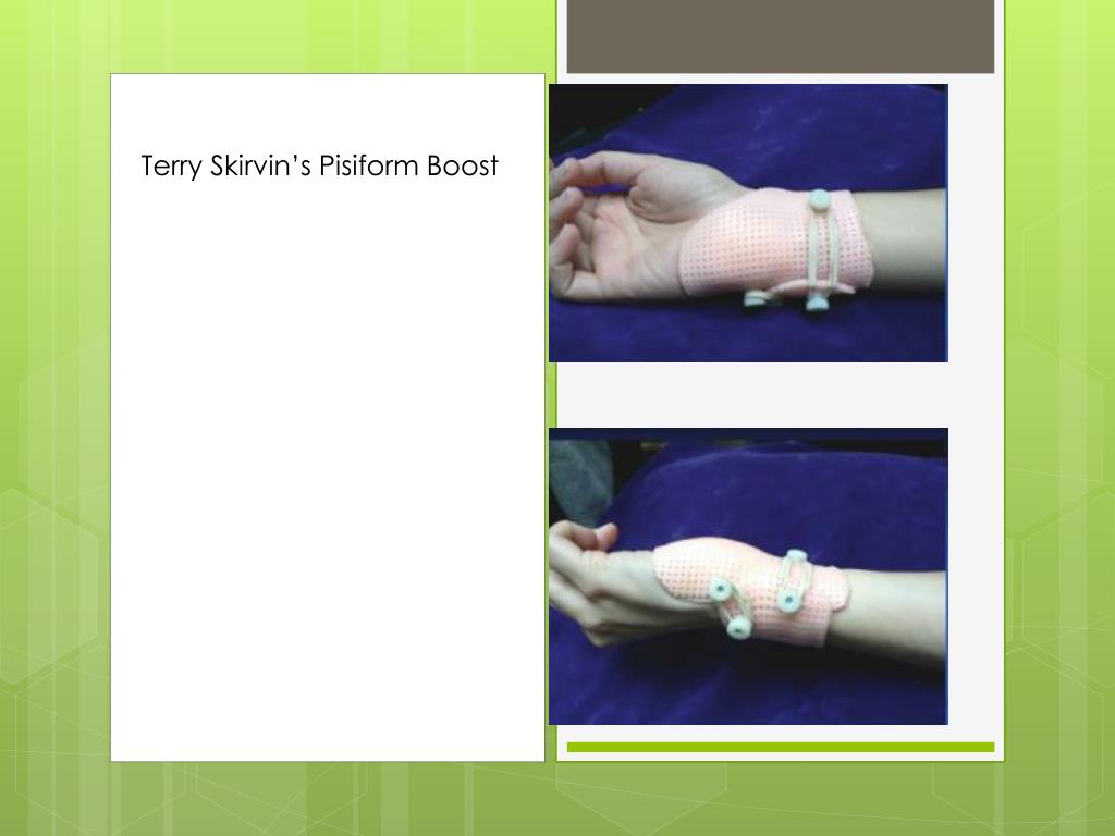 PPT - Pediatric Sports Injuries of the Wrist and Hand PowerPoint ...