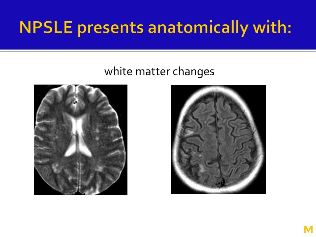 PPT - N- Acetylaspertate (NAA) as a biomarker for disease in ...