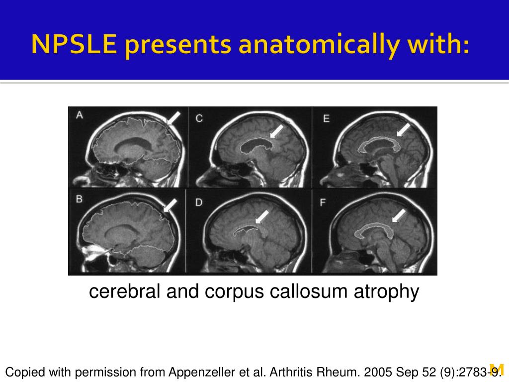 PPT - N- Acetylaspertate (NAA) as a biomarker for disease in ...