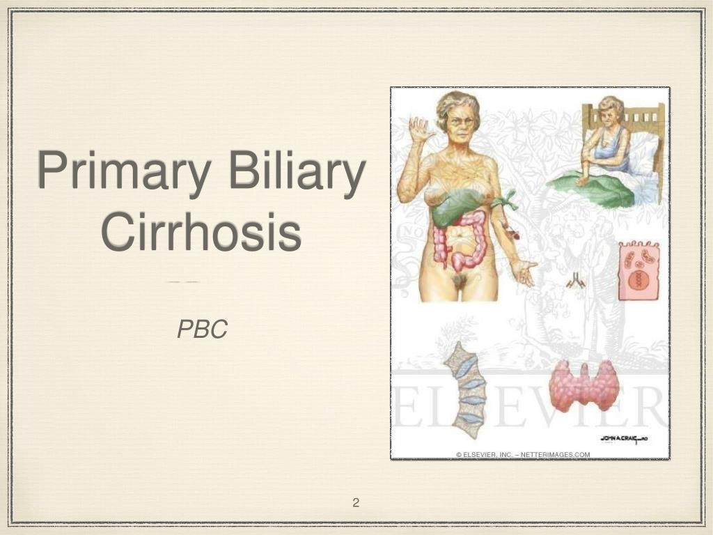 PPT - Primary Biliary Cirrhosis & Hemochromatosis PowerPoint ...