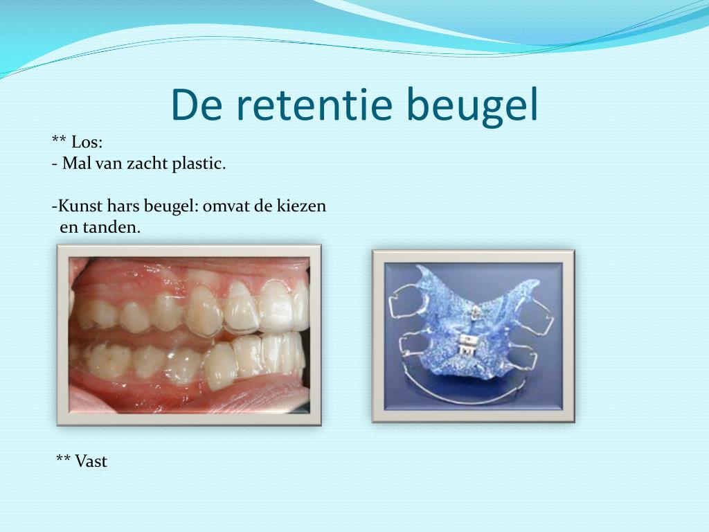 PPT - Over 1 minuutje ga ik beginnen, maar nu eerst….. PowerPoint ...