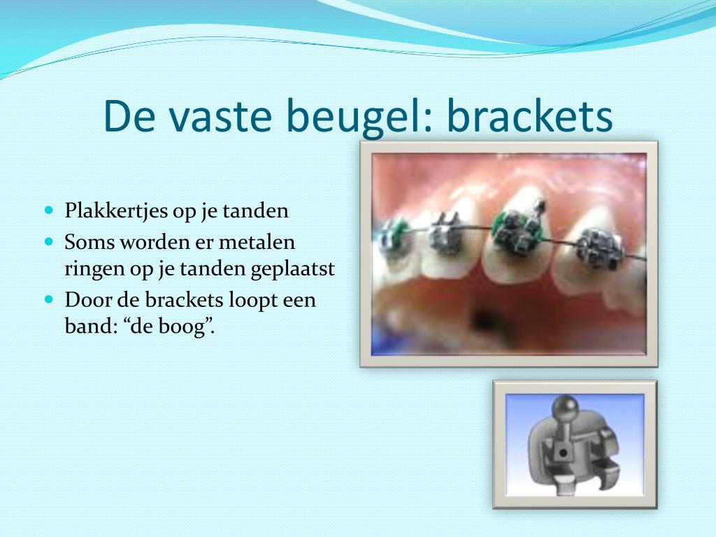PPT - Over 1 minuutje ga ik beginnen, maar nu eerst….. PowerPoint ...
