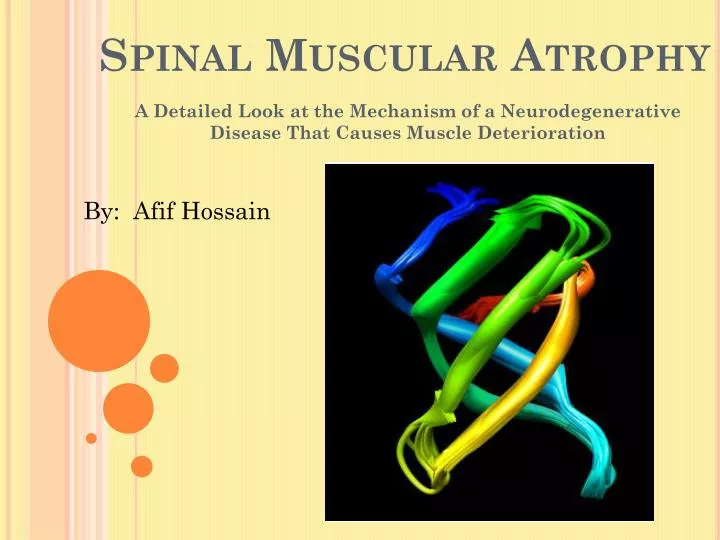 PPT - Spinal Muscular Atrophy PowerPoint Presentation, free download ...