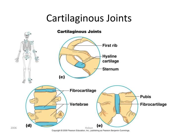 PPT - Ch 5f: The Skeletal System PowerPoint Presentation - ID:2321879