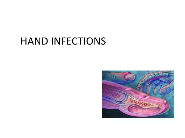 PPT - HAND INFECTIONS PowerPoint Presentation, free download - ID:2323448