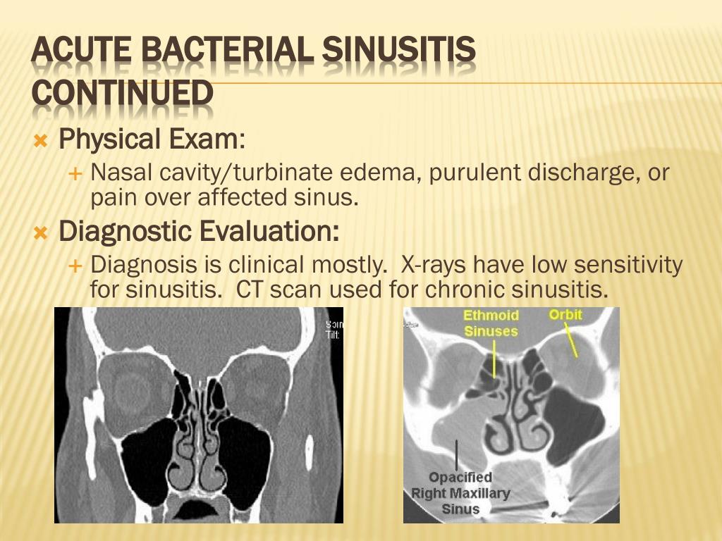 PPT - Otorhinolaryngology Disorders of the Ear, nose and throat ...