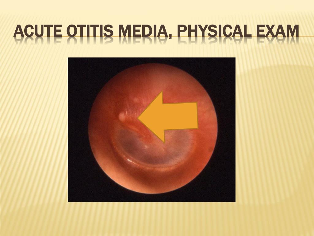 PPT - Otorhinolaryngology Disorders of the Ear, nose and throat ...