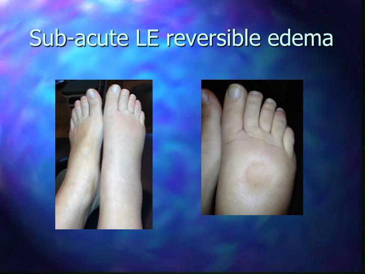 PPT - Introduction to Manual Edema Mobilization (MEM) PowerPoint ...