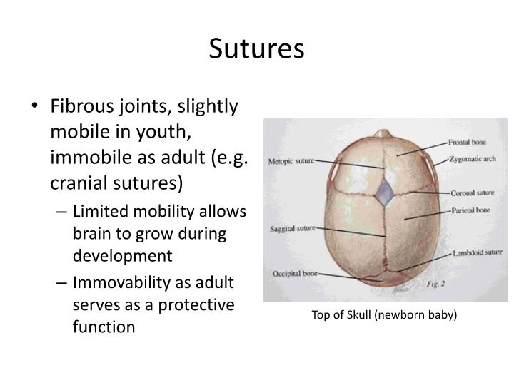 PPT - Joints PowerPoint Presentation - ID:2325082