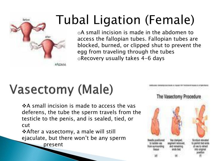 Ppt Contraception Powerpoint Presentation Id 2327722
