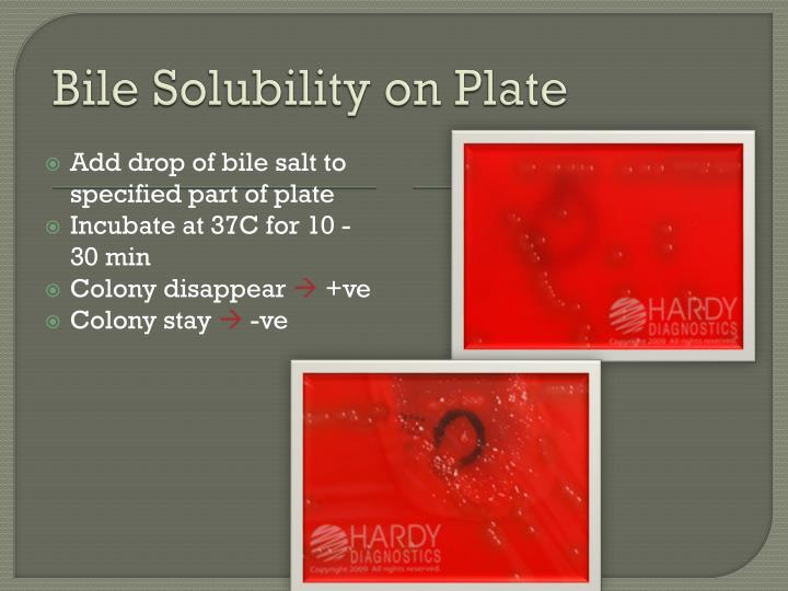 PPT - STREPTOCOCCUS PowerPoint Presentation - ID:2327955