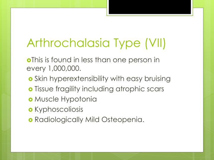 PPT - Ehlers-Danlos Syndrome PowerPoint Presentation - ID:2328495