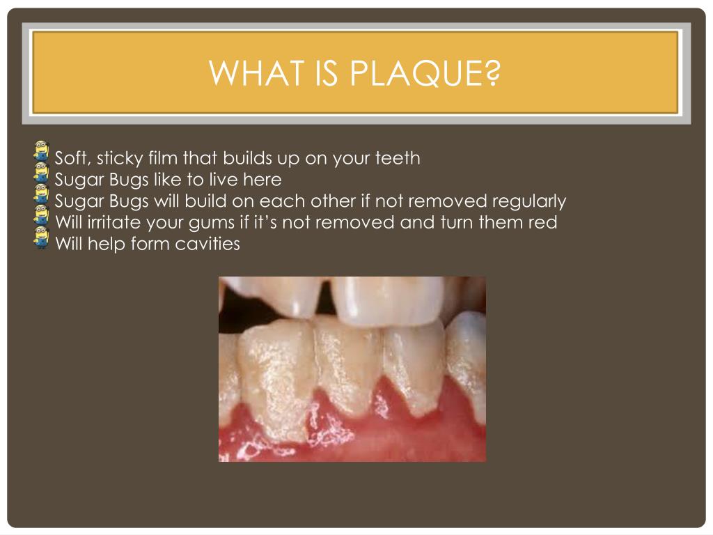PPT - Healthy Smiles BY: Miss Miranda and Miss Sarah PowerPoint ...