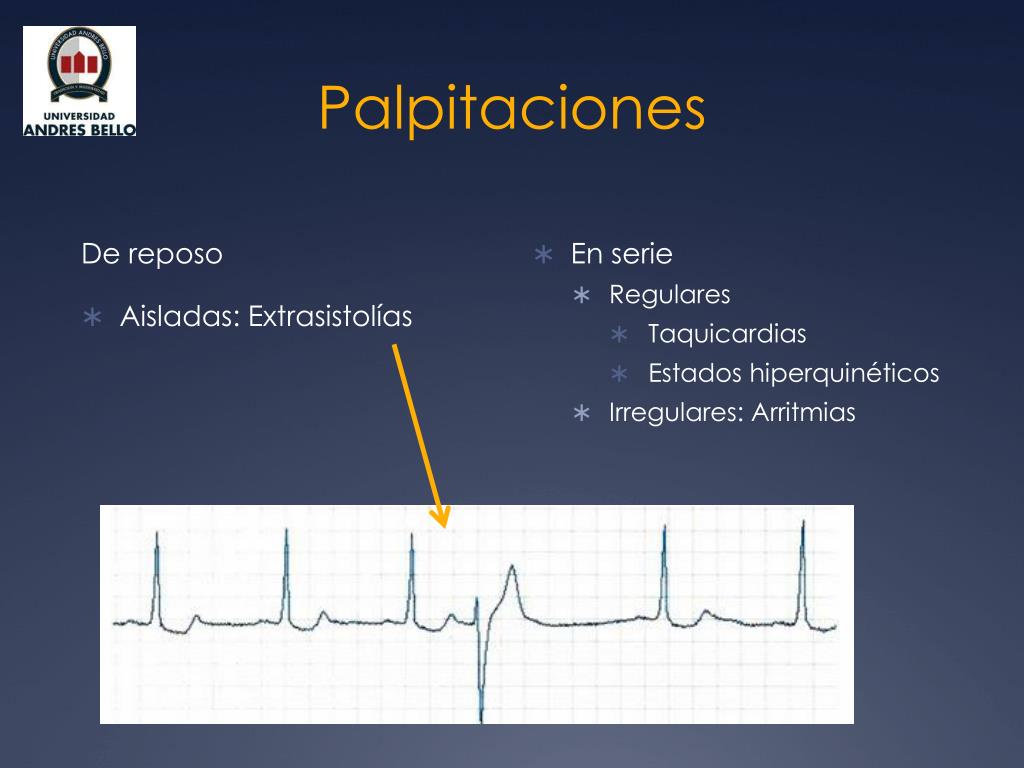 PPT - Síntomas y signos cardiovasculares PowerPoint Presentation, free ...