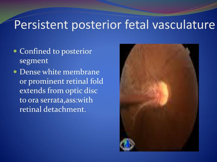 PPT - White Pupillary reflex in children PowerPoint Presentation - ID ...