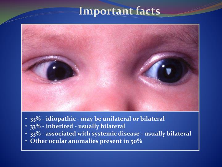 PPT - White Pupillary reflex in children PowerPoint Presentation - ID ...