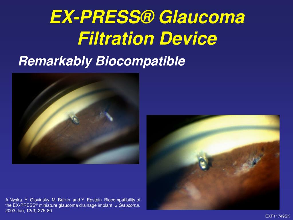 PPT - Glaucoma Surgery 2011: Why am I Still Doing a Trabeculectomy ...
