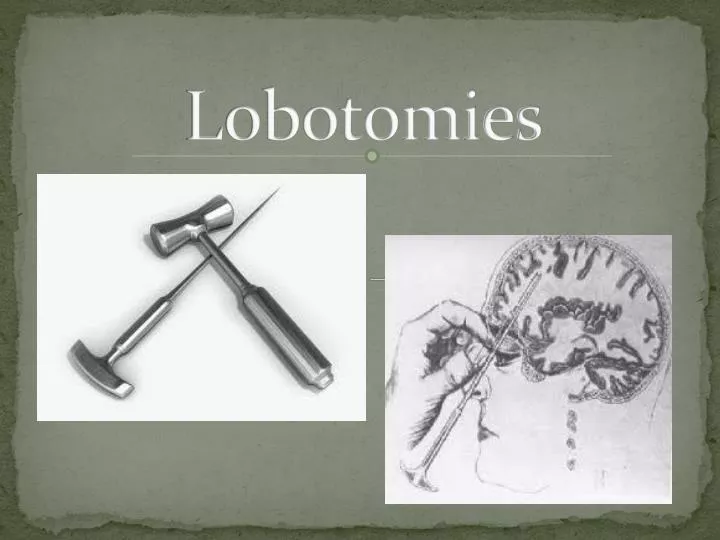 PPT - Lobotomies PowerPoint Presentation, free download - ID:2332936